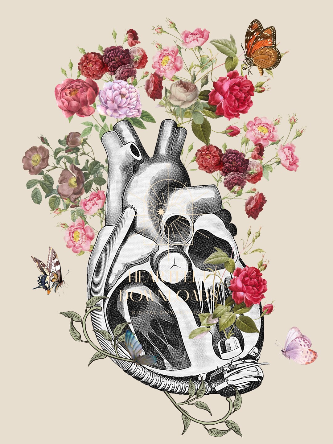 LVAD Botanical Print - Etsy