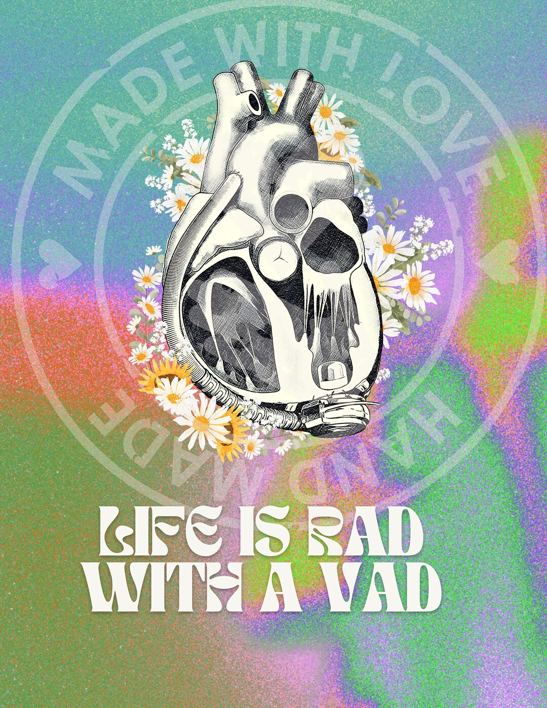 Hippie LVAD Print - Etsy