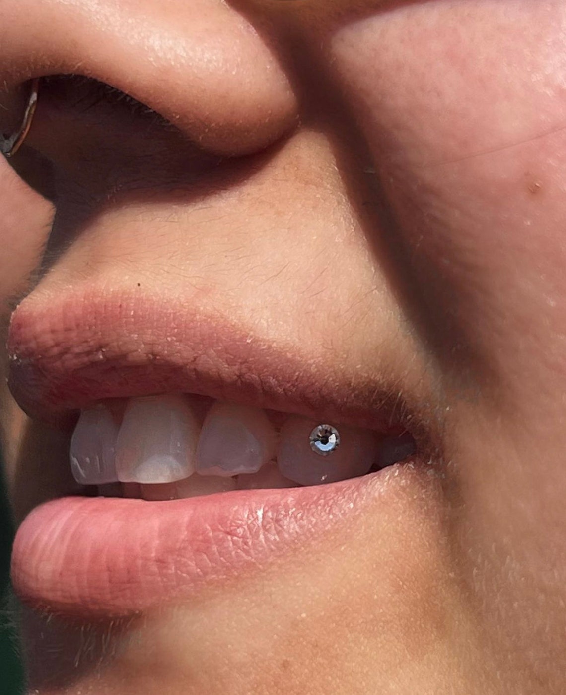 DIY Tooth Gem Kit for Natural & Artificial Teeth - Etsy