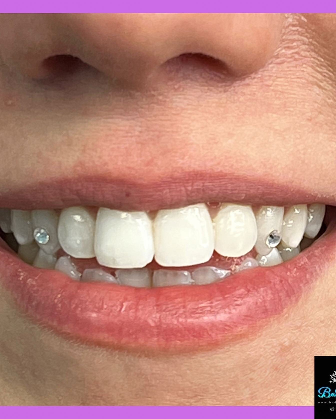 DIY Tooth Gem Kit for Natural & Artificial Teeth - Etsy