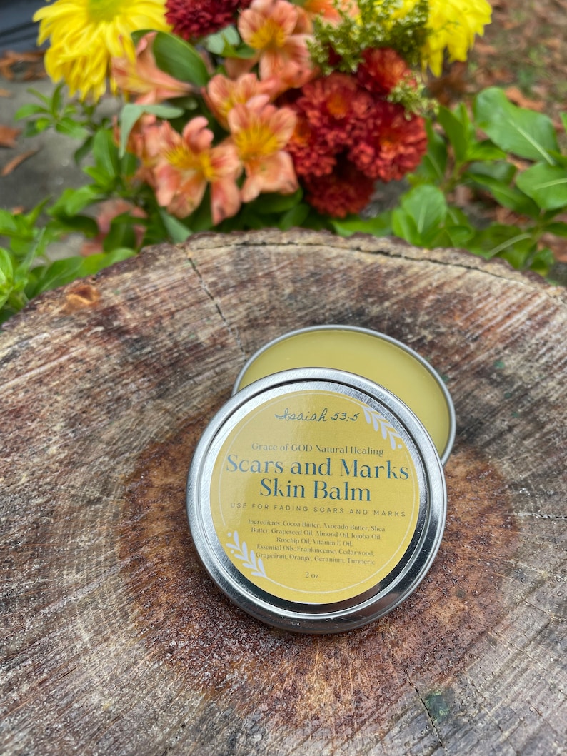 Scars and Marks Skin Balm - Etsy