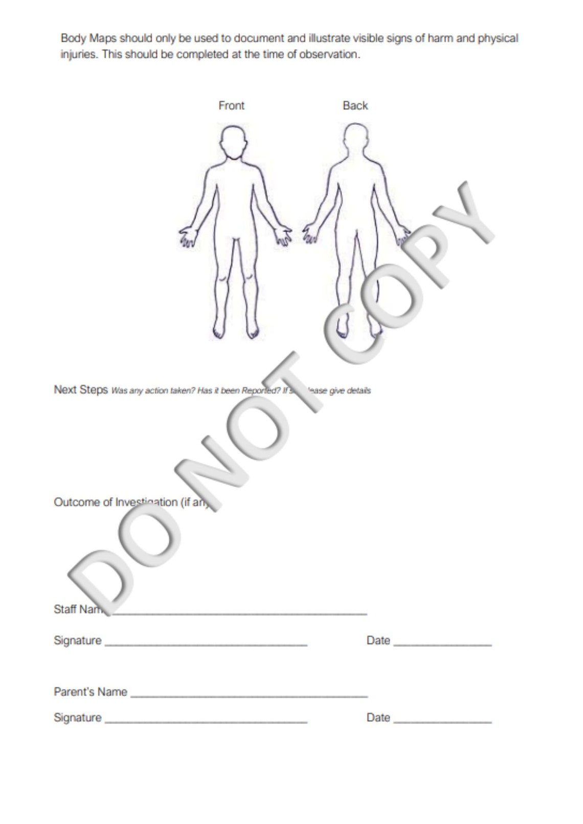 Record of Concern, Printable, Form, Daycare, Editable, Childcare ...