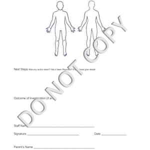 Record of Concern, Printable, Form, Daycare, Editable, Childcare ...