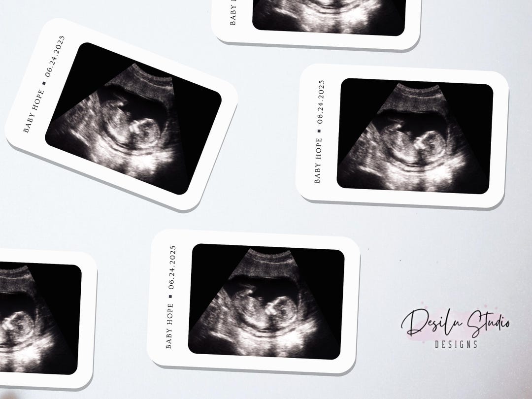 Custom Ultrasound Photo Confetti | Baby Shower Decor, Gender Reveal - Etsy