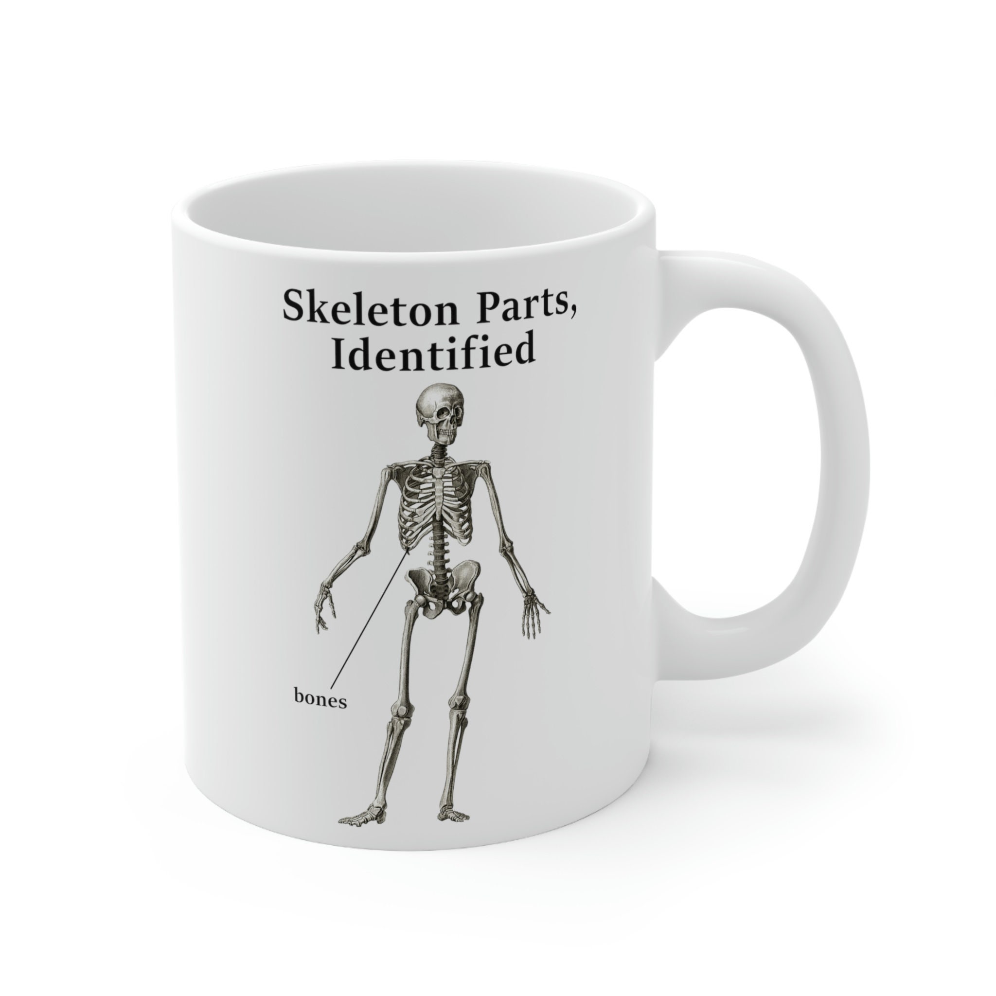 Skeleton Meme Mug, Skeleton Parts Identified Funny Mug - Etsy
