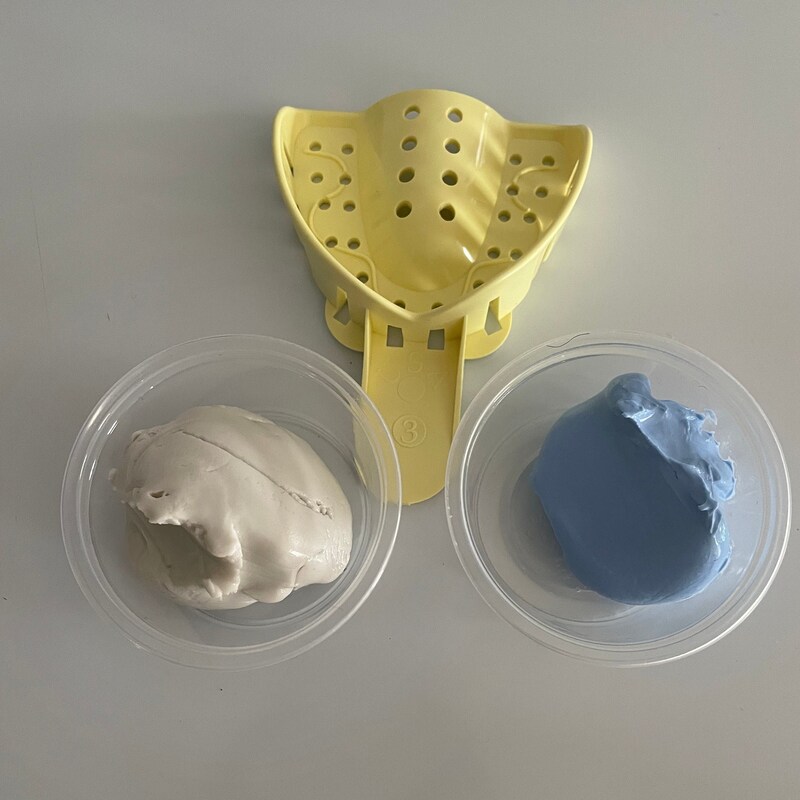 Dental Impression Kit - Etsy