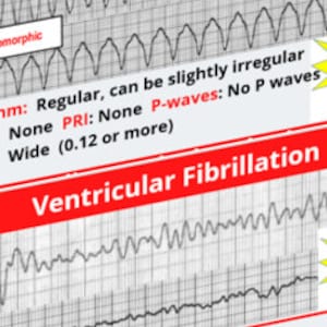 ACLS Reference Study Guide Cardiac Arrest, Shockable, Non-shockable ...