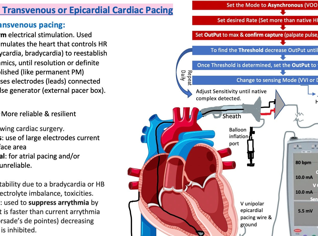 Temporary Transvenous or Epicardial Cardiac Pacing Reference Guide for ...