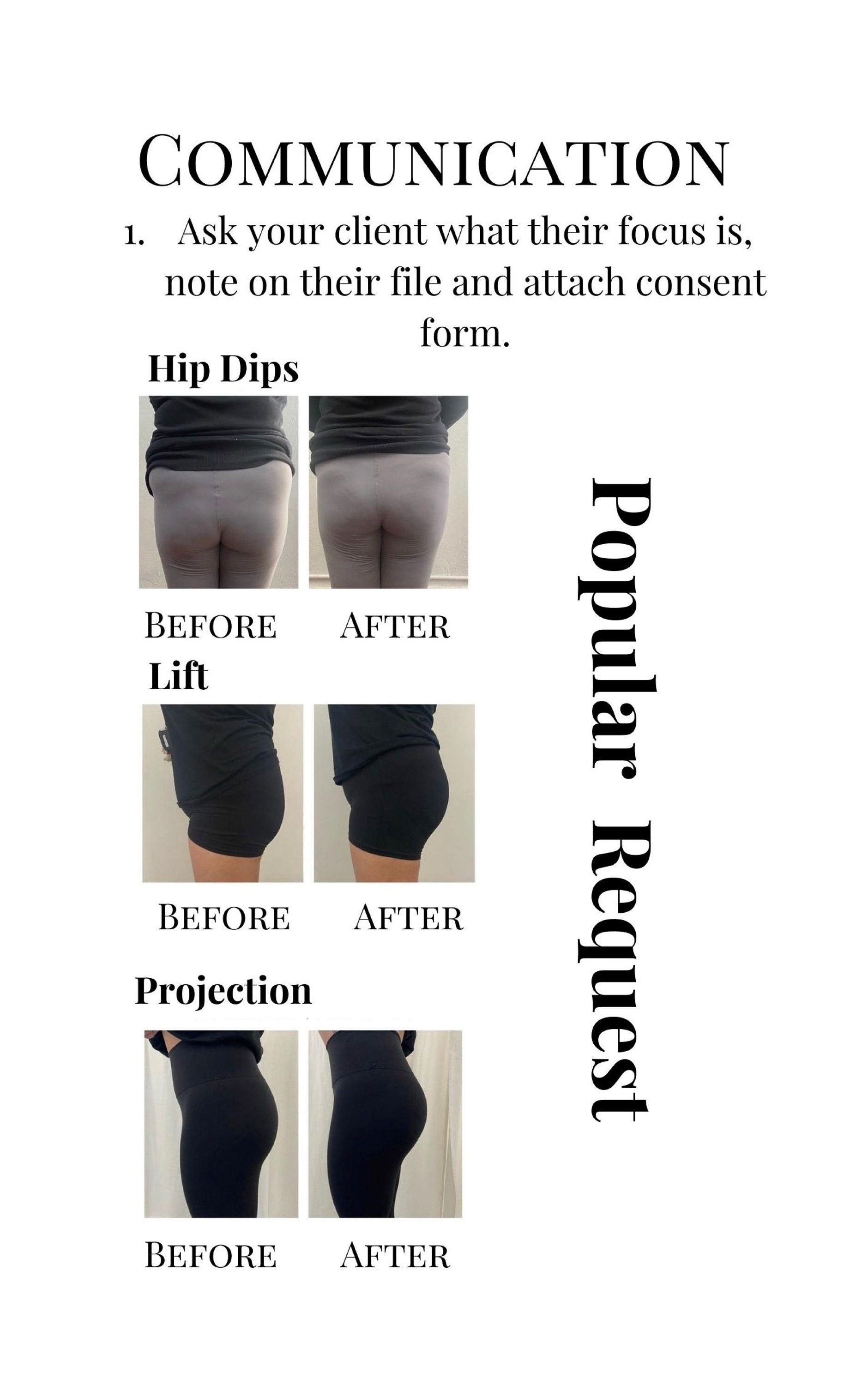 Noninvasive BBL 101: Settings Guide - Etsy