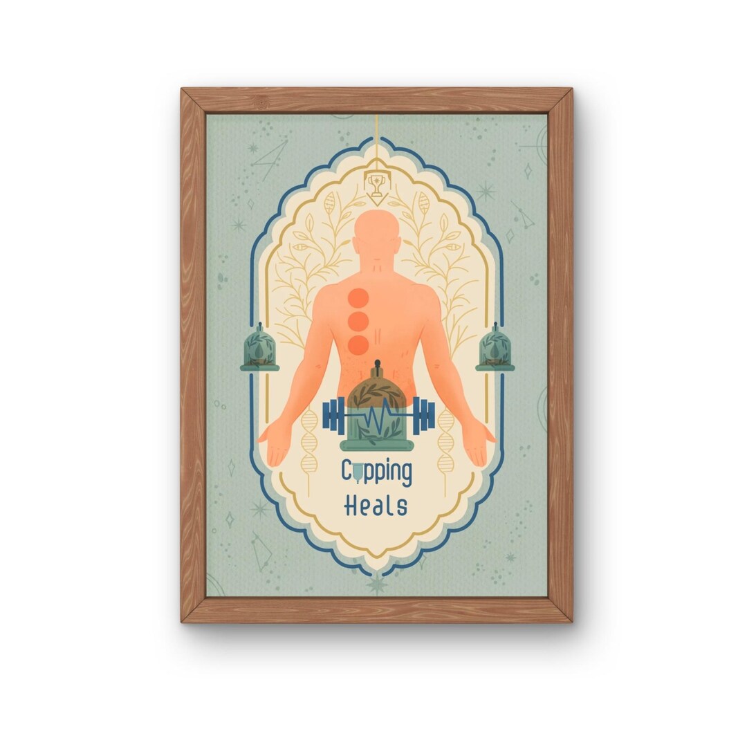 Cupping Heals Poster 48.8cm X 33cm, Stylish Wall Decoration - Etsy