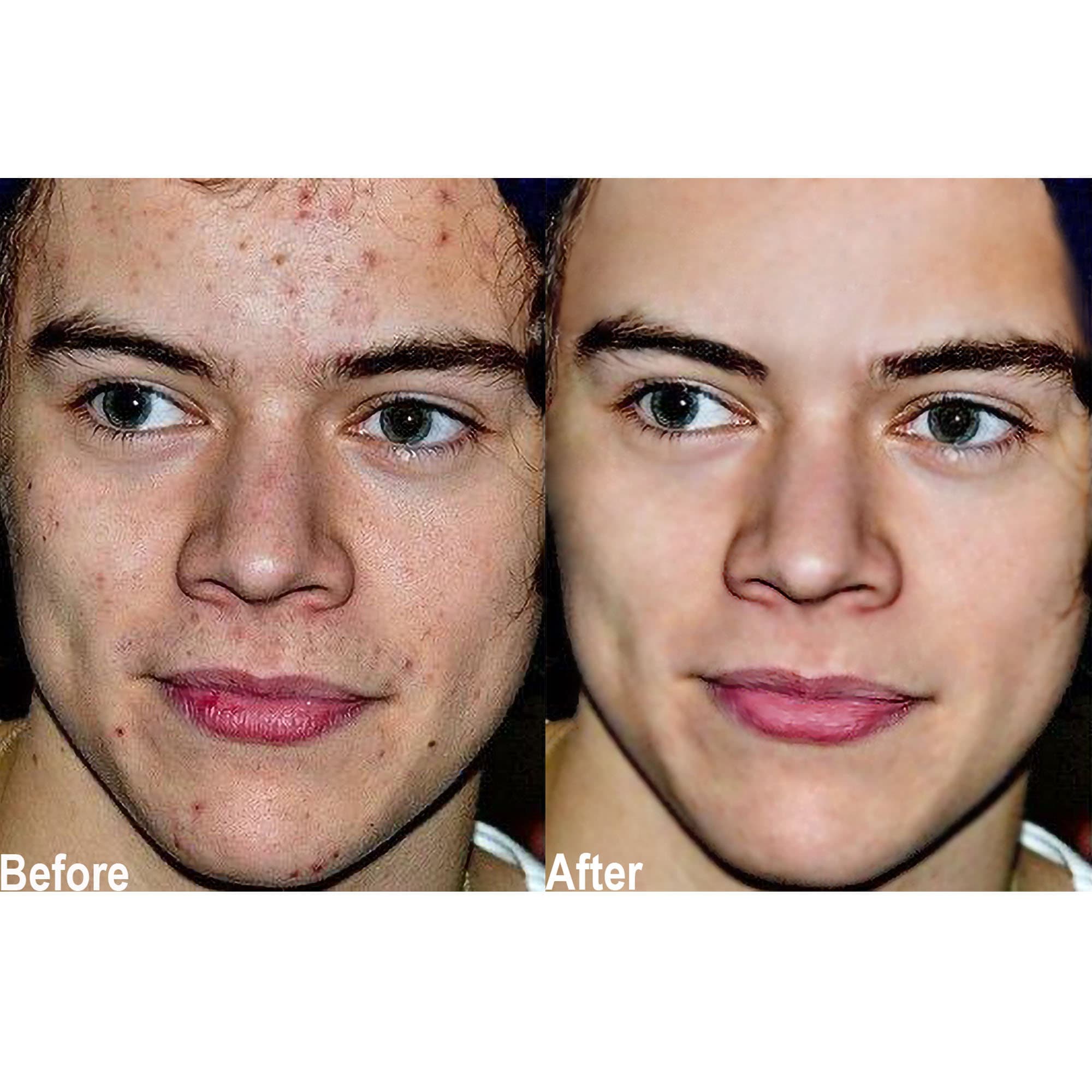 Advanced Photo Retouching Service / Custom Photo Editing / Face Retouch ...