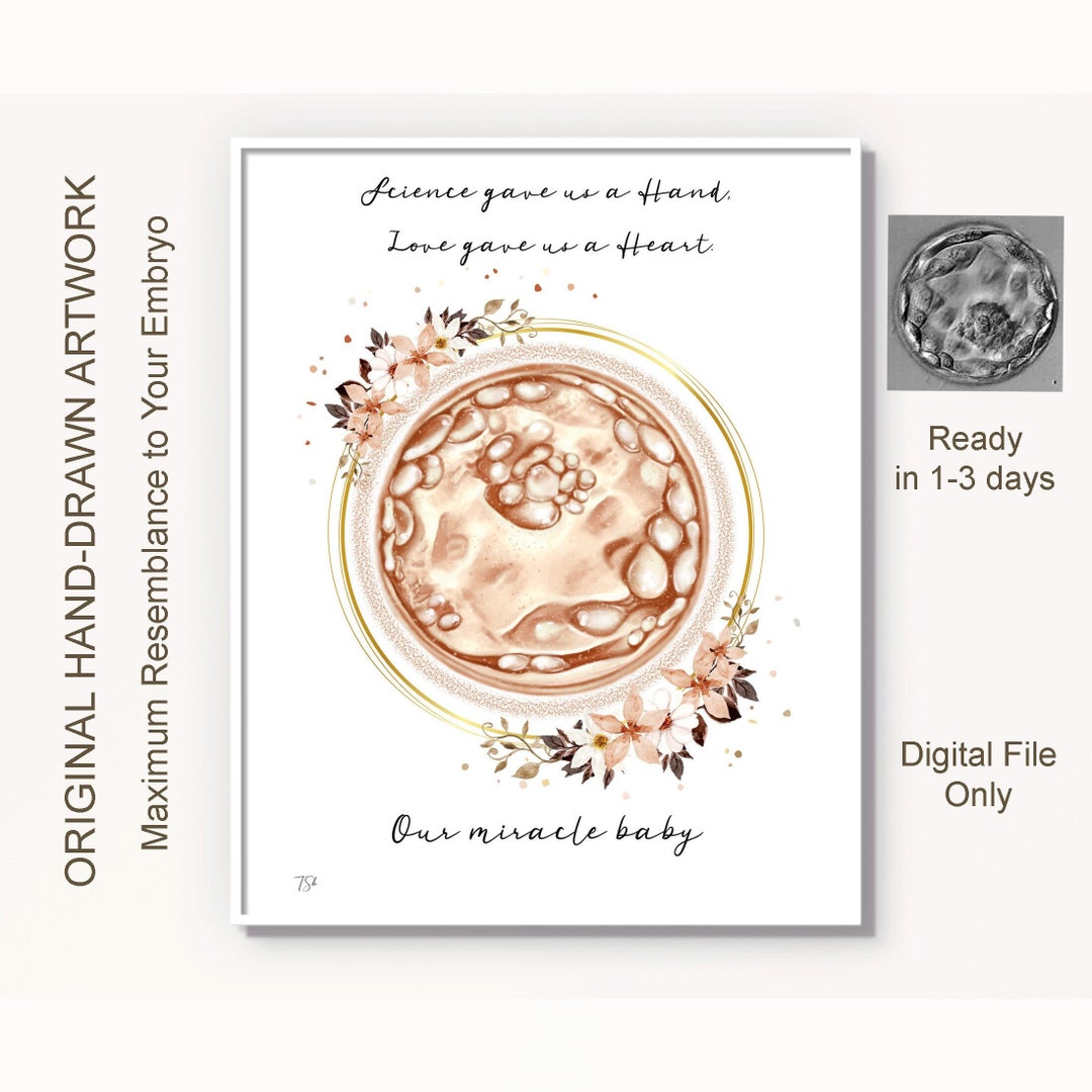 Custom IVF Embryo Watercolor Art Personalized Unique Pregnancy Gift ...