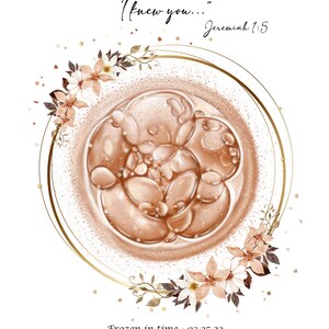 Custom IVF Embryo Watercolor Art, Personalized Unique IVF Embryo, IVF ...