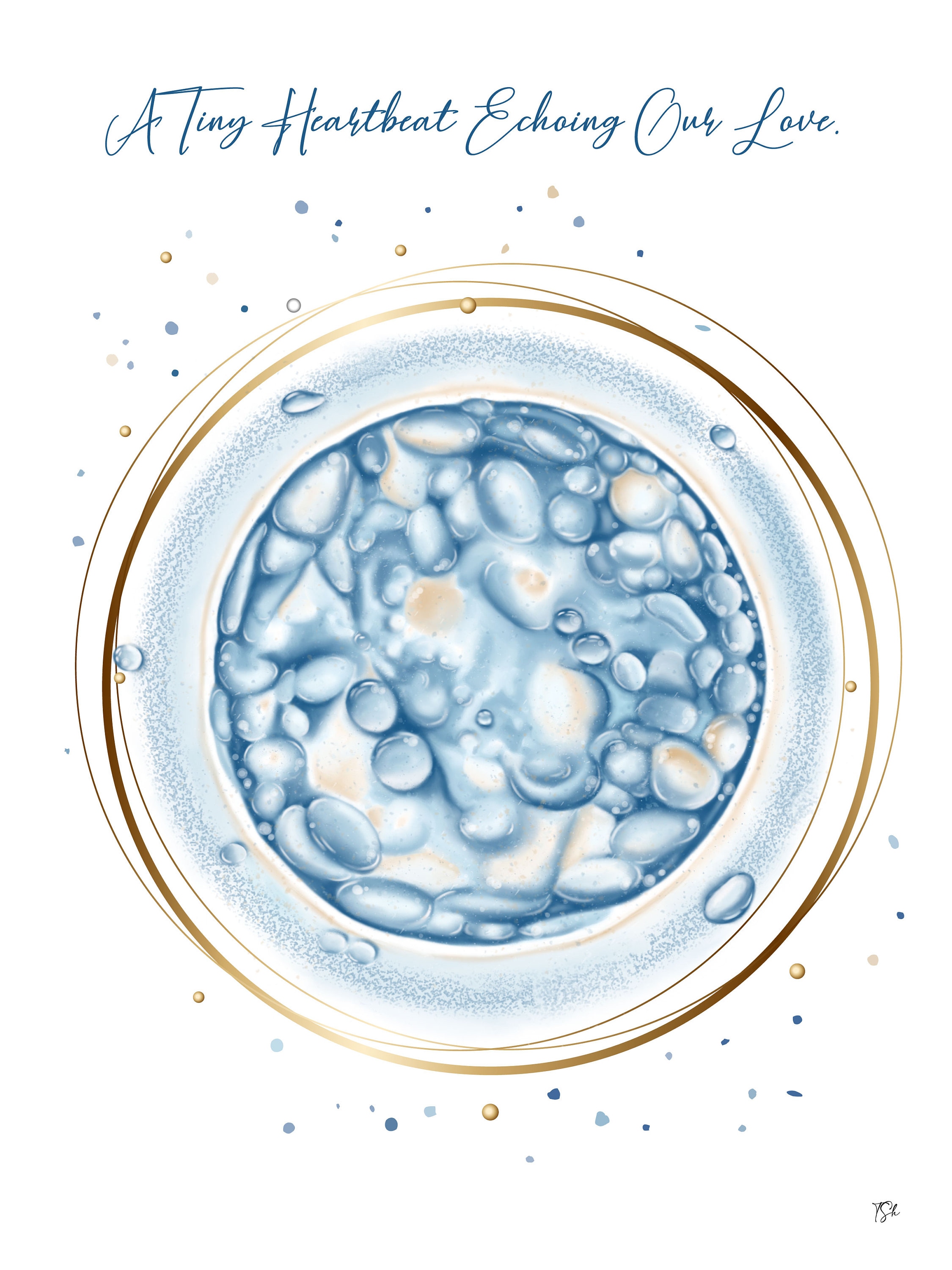 Custom Embryo Art IVF Watercolor Personalized Pregnancy Gift - Etsy