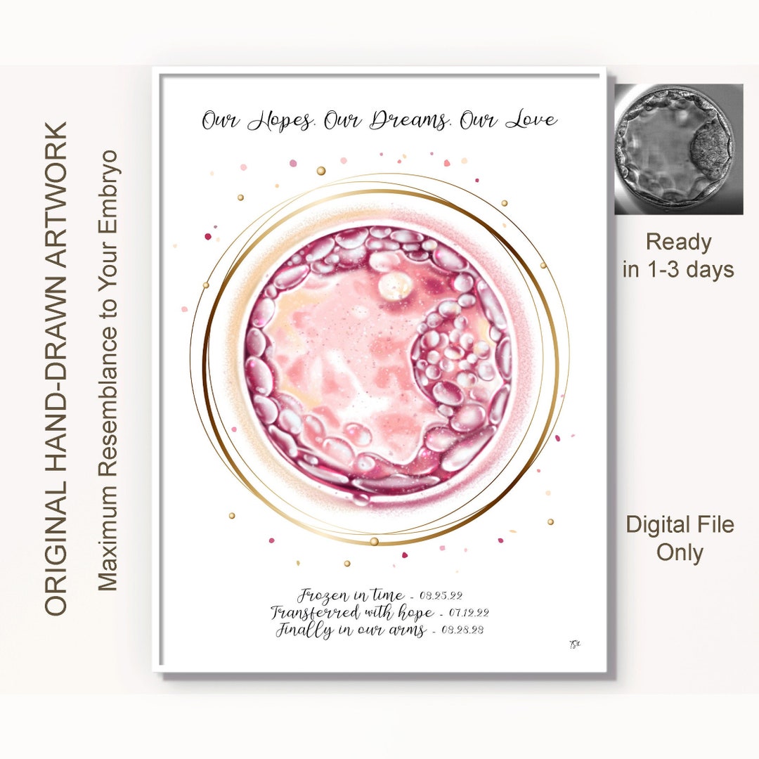 IVF Embryo Art Hand Painted Watercolor 3d Embryo Print Pregnancy Loss ...