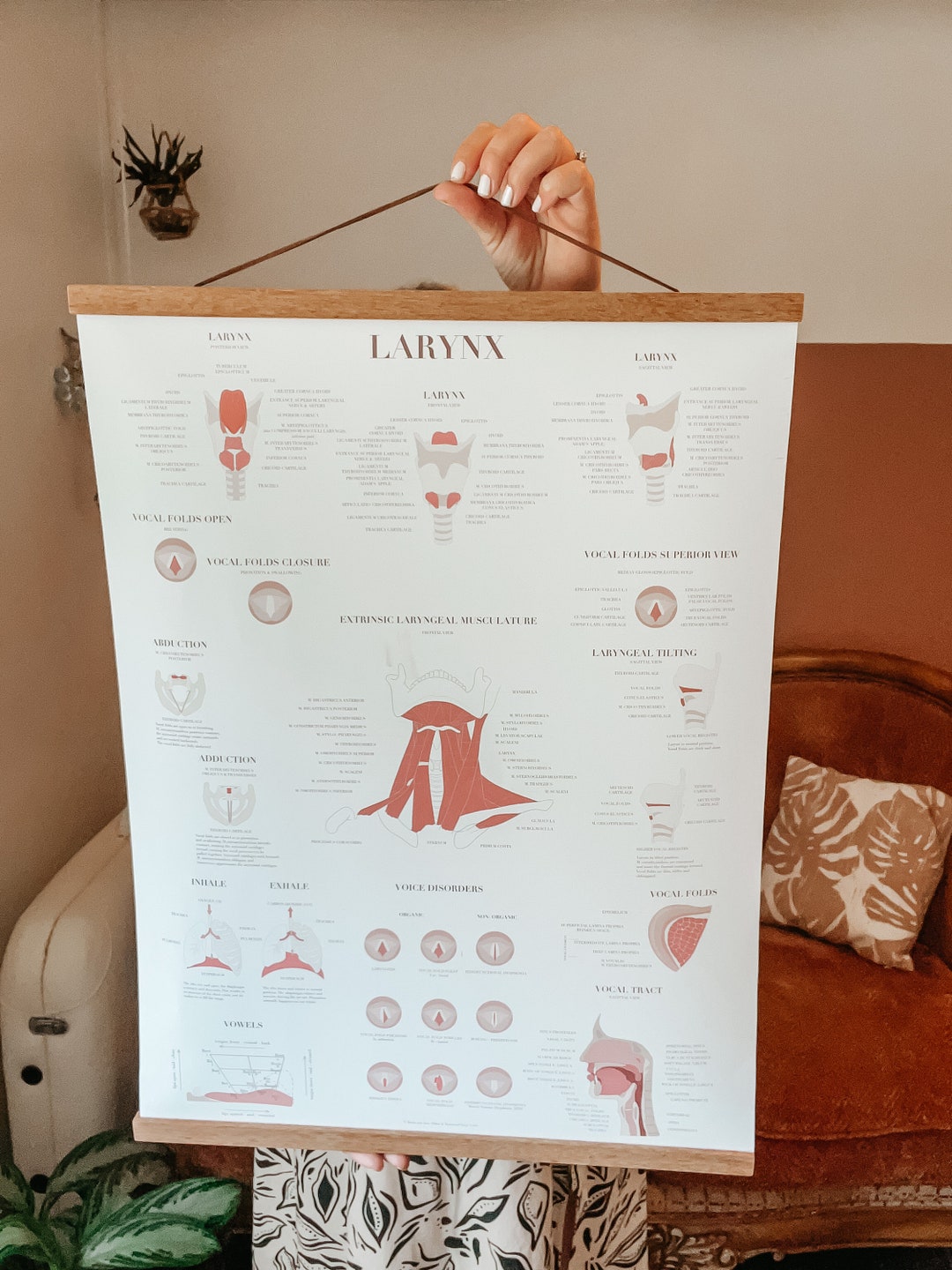 Larynx Poster for Professionals I DIGITAL - Etsy
