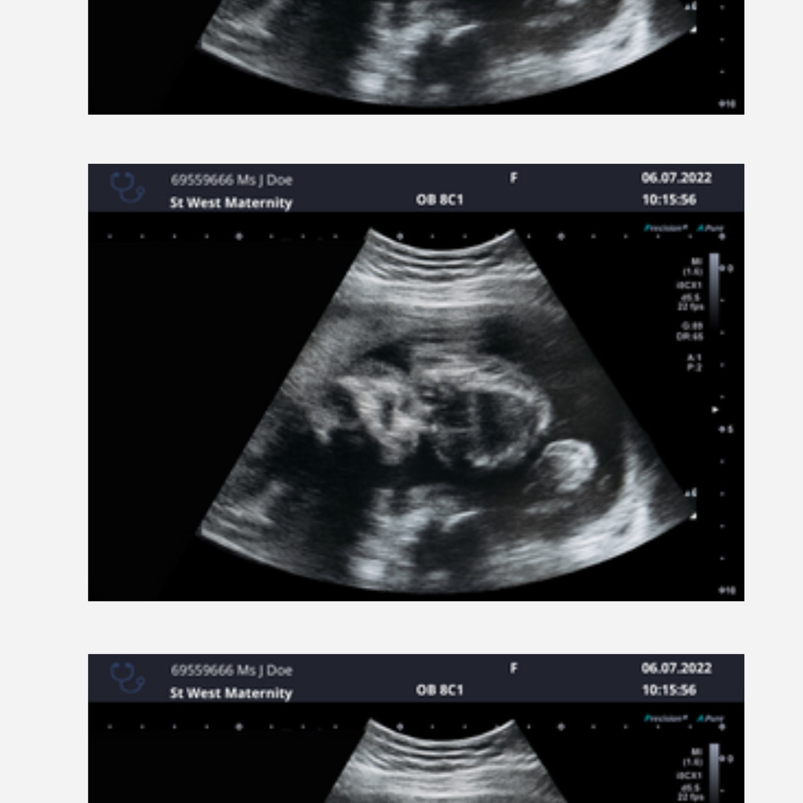 Real Ultrasound Picture Personalized Ultrasounds Digital - Etsy