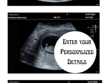 Pregnancy Scan Fake - Etsy
