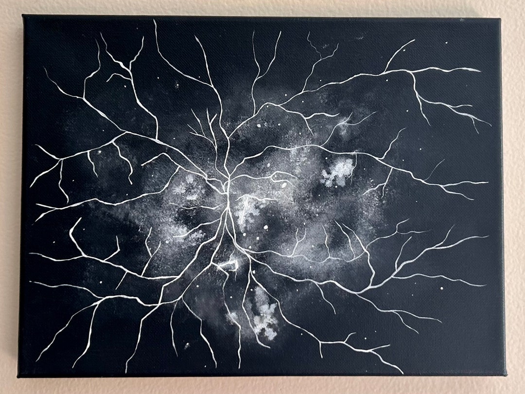 Fluorescein Angiography of Retina Painting, Human Eye, Blood Vessels ...