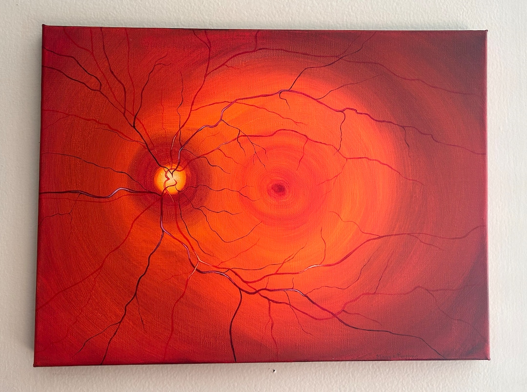 Retina Painting, Hand Painted, Optic Nerve, Blood Vessels, Original ...