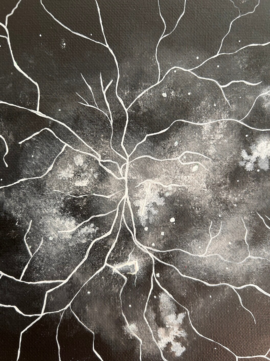 Fluorescein Angiography of Retina Painting, Human Eye, Blood Vessels ...