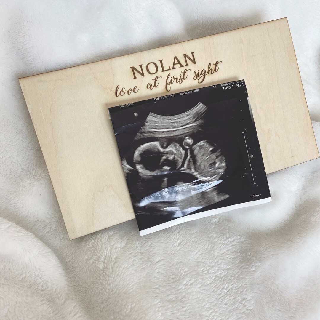 Baby Sonogram Magnet Ultrasound Photo Picture Display Sign for ...