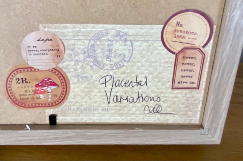 Placenta Display - Variations of Normal Physiology - Etsy