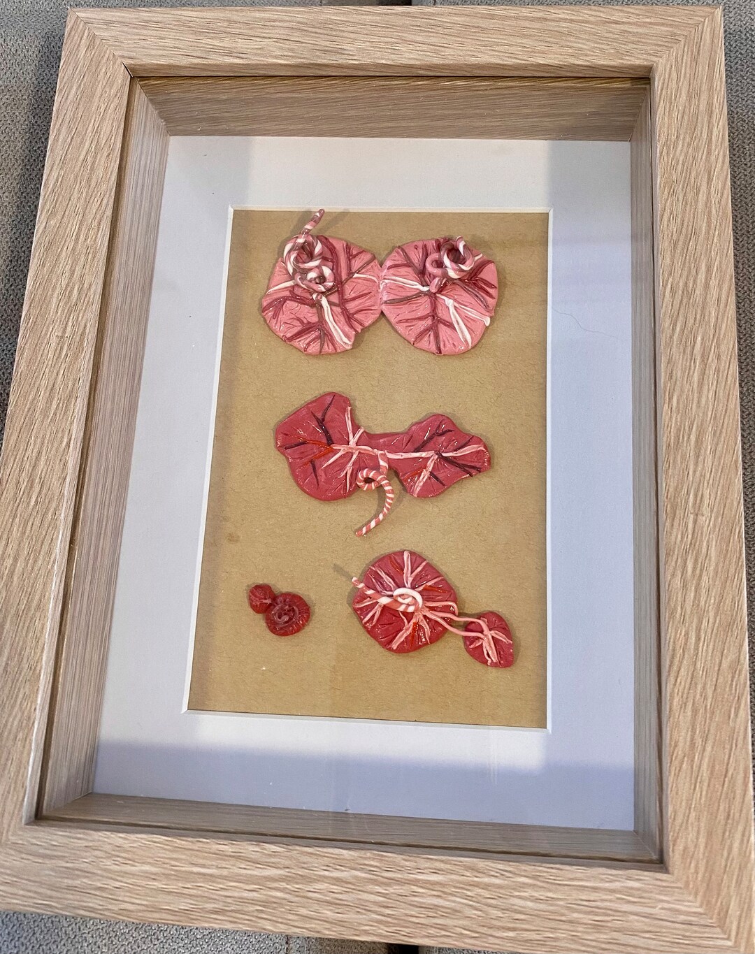 Placenta Display - Variations of Normal Physiology - Etsy
