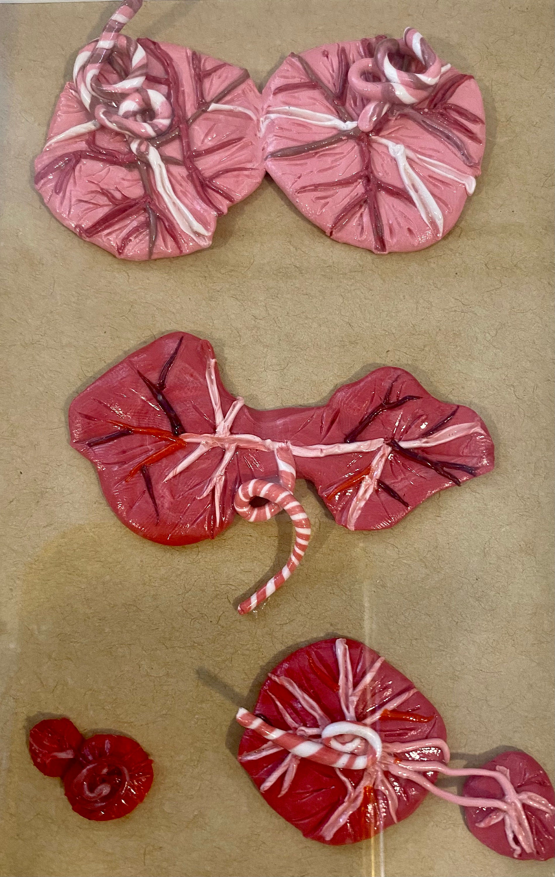 Placenta Display - Variations of Normal Physiology - Etsy