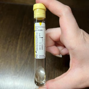 5 BD ACD-A Vacutainer Tubes PRP Tubes Acid Citrate Dextrose and ...