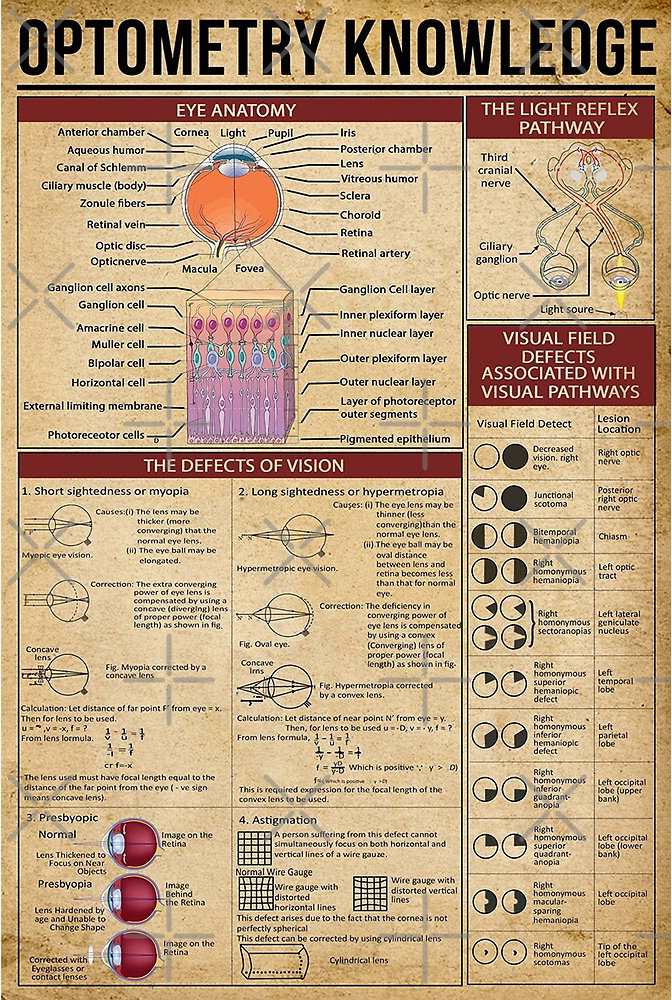 Optometry Knowledge Poster Posters Optometrist Guide Vintage - Etsy