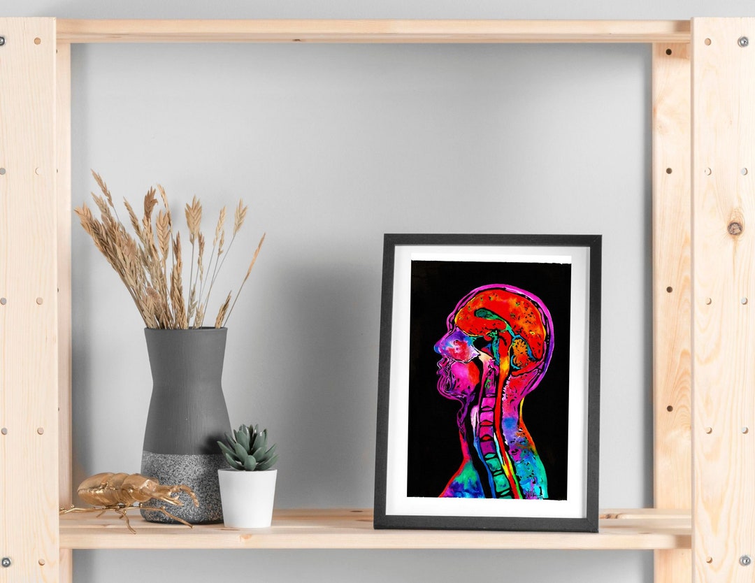 Brain Scan Art - PET Scan Art - Watercolor Painting - ADD Art - Doctors ...