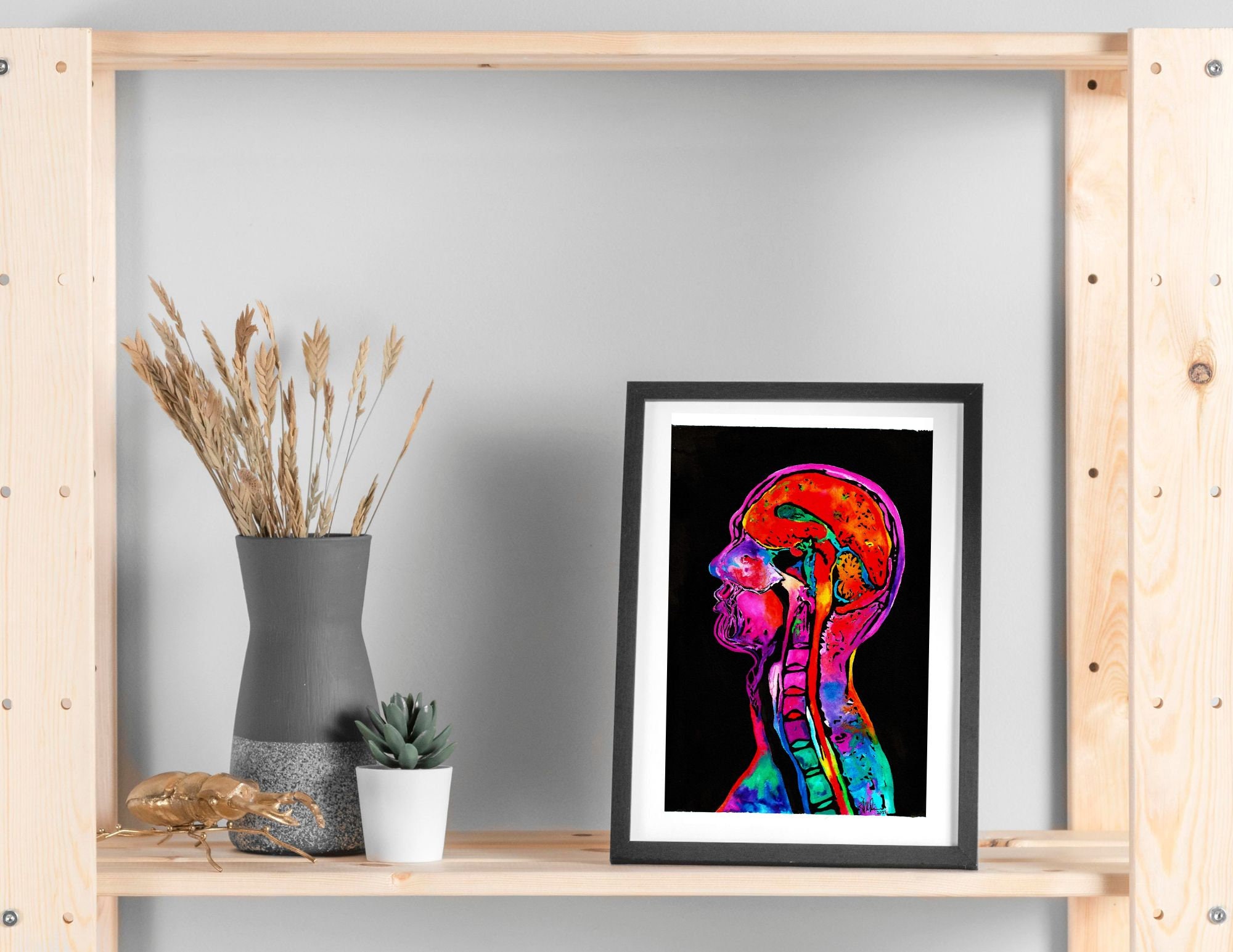 Brain Scan Art PET Scan Art Watercolor Painting ADD Art Doctors Office ...