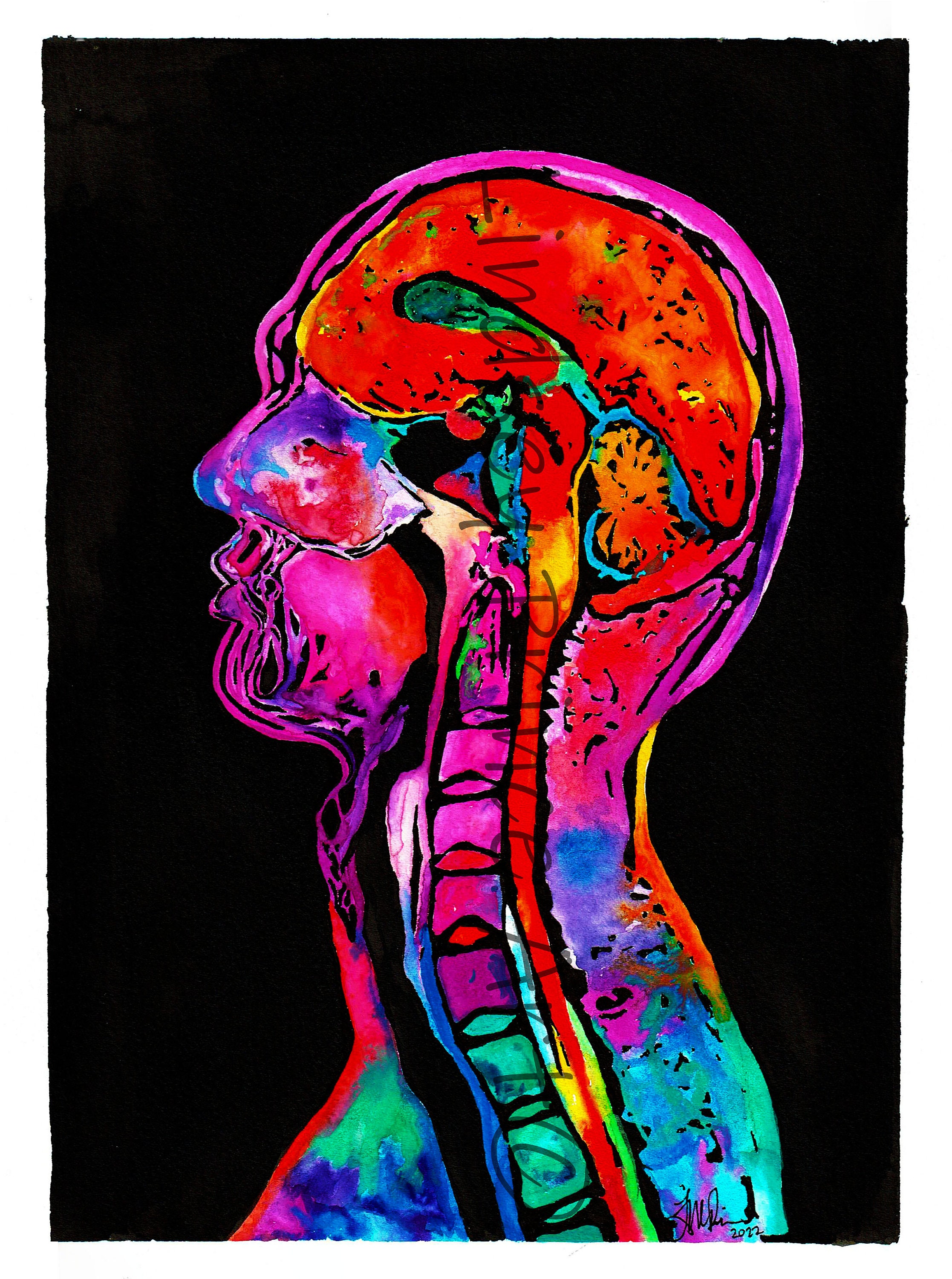 Brain Scan Art PET Scan Art Watercolor Painting ADD Art Doctors Office ...