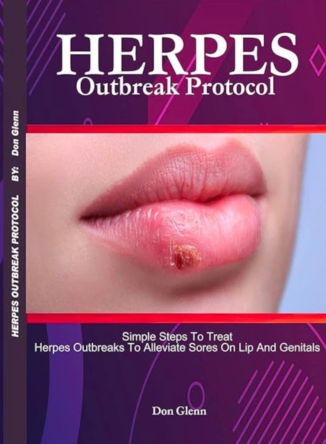 Herpes Outbreak Protocol - Etsy