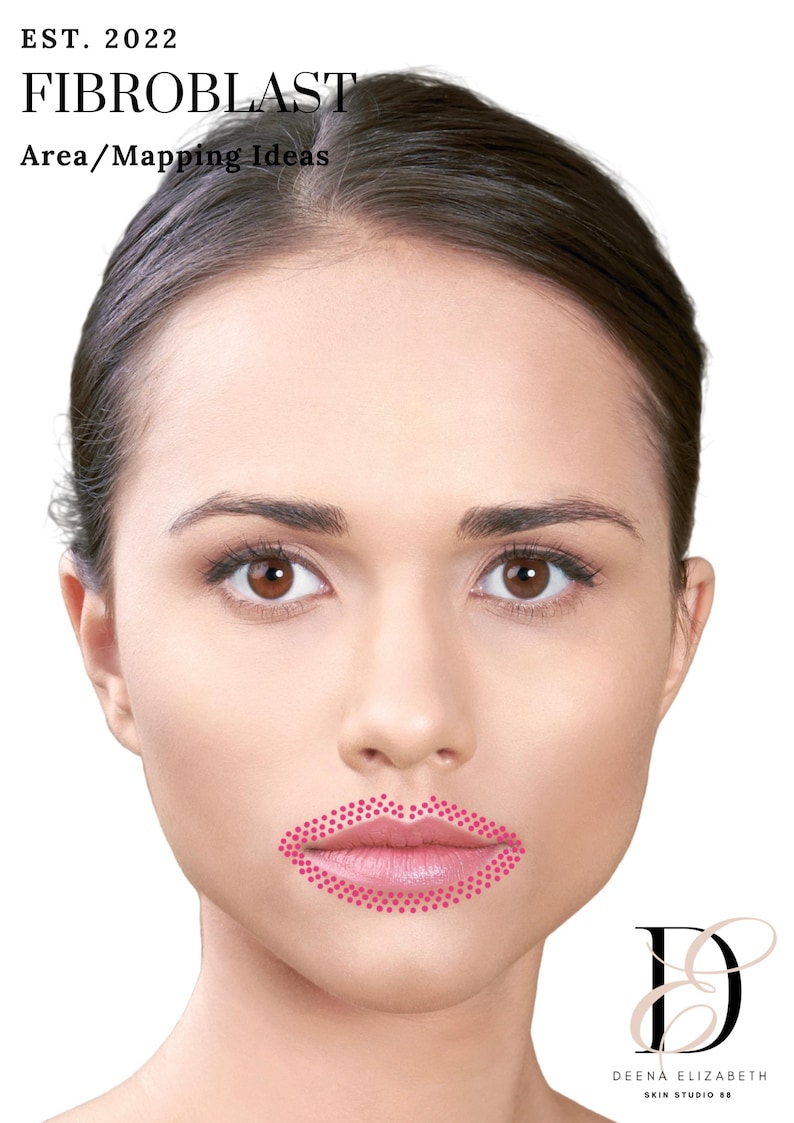 Fibroblast Plasma Editable Mapping Guide - Etsy