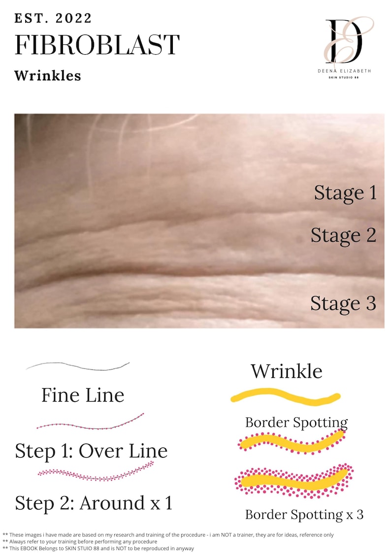 Fibroblast Plasma Editable Mapping Guide - Etsy