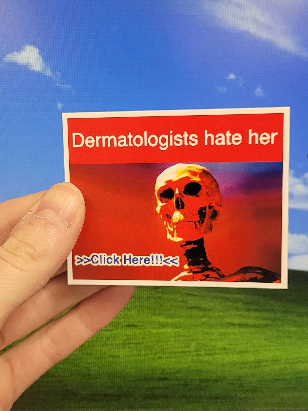 Internet Meme Vinyl Sticker | Dermatologists Hate Her | Waterproof Sticker for Laptop or Water ...