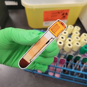 Blood Tube Sticker | Waterproof Laptop Water Bottle Vinyl Sticker - Etsy