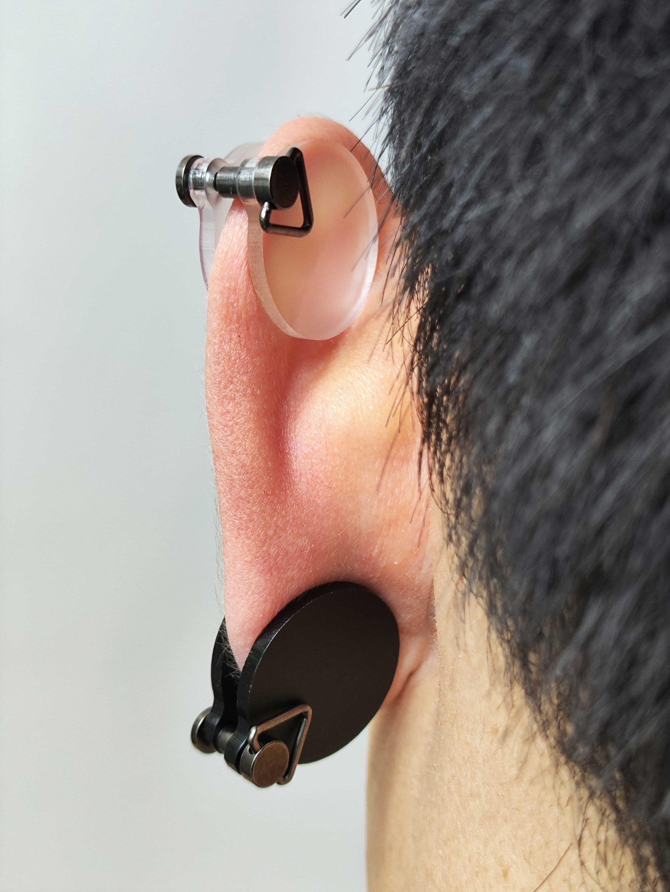 20mm 0.79 Keloid Earring Compression. Keloid Prevention Earring ...