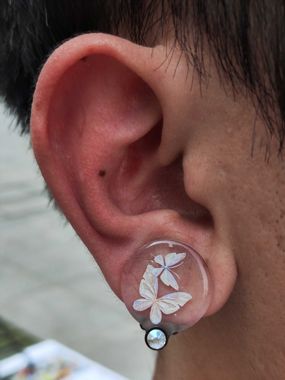 20mm 0.79 Keloid Earring Compression. Keloid Prevention Earring ...