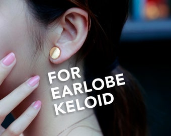 Keloid Pressure Earrings - Etsy