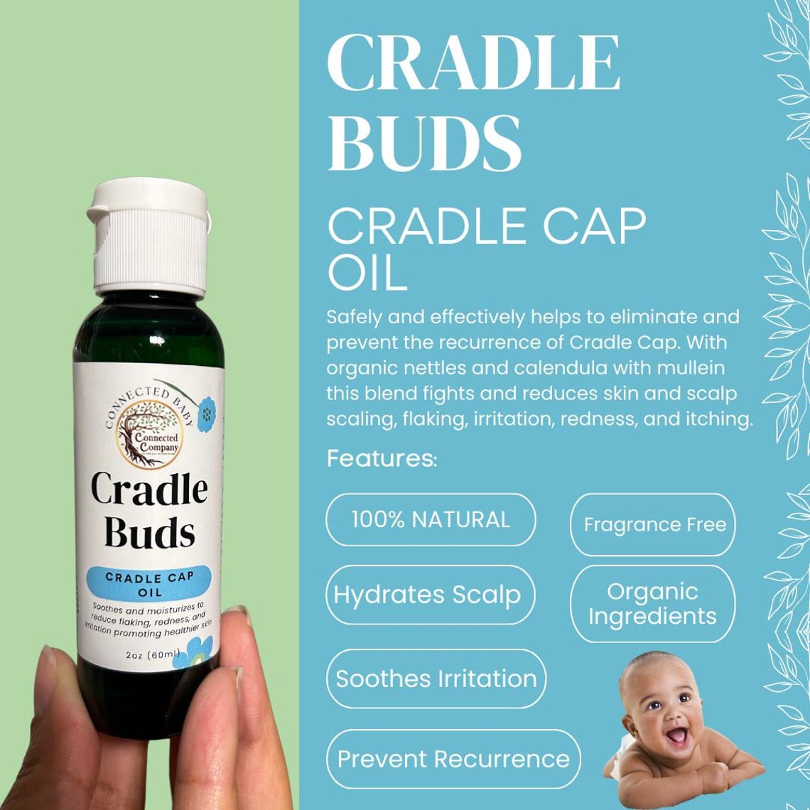 Cradle Buds: Cradle Cap Oil - Etsy