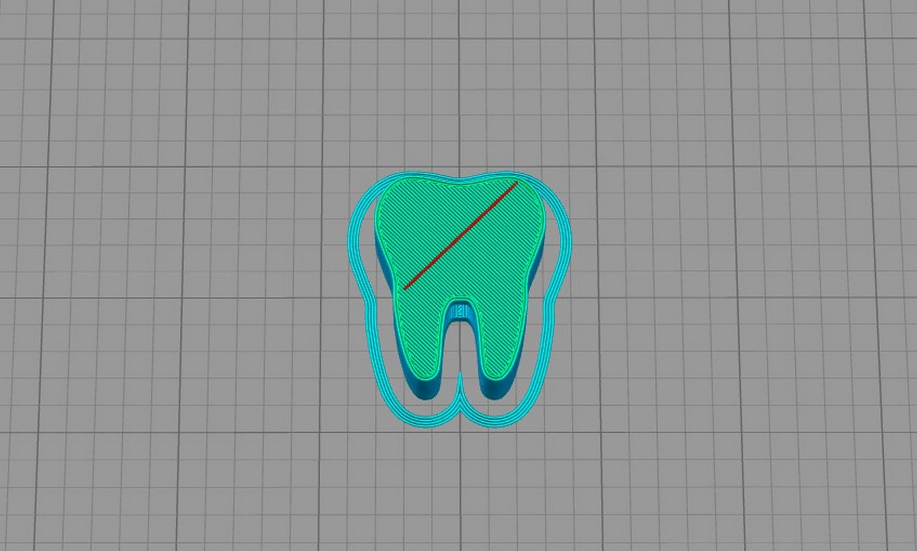 Tooth Straw Topper STL File for 3D Printing Dentist - Etsy