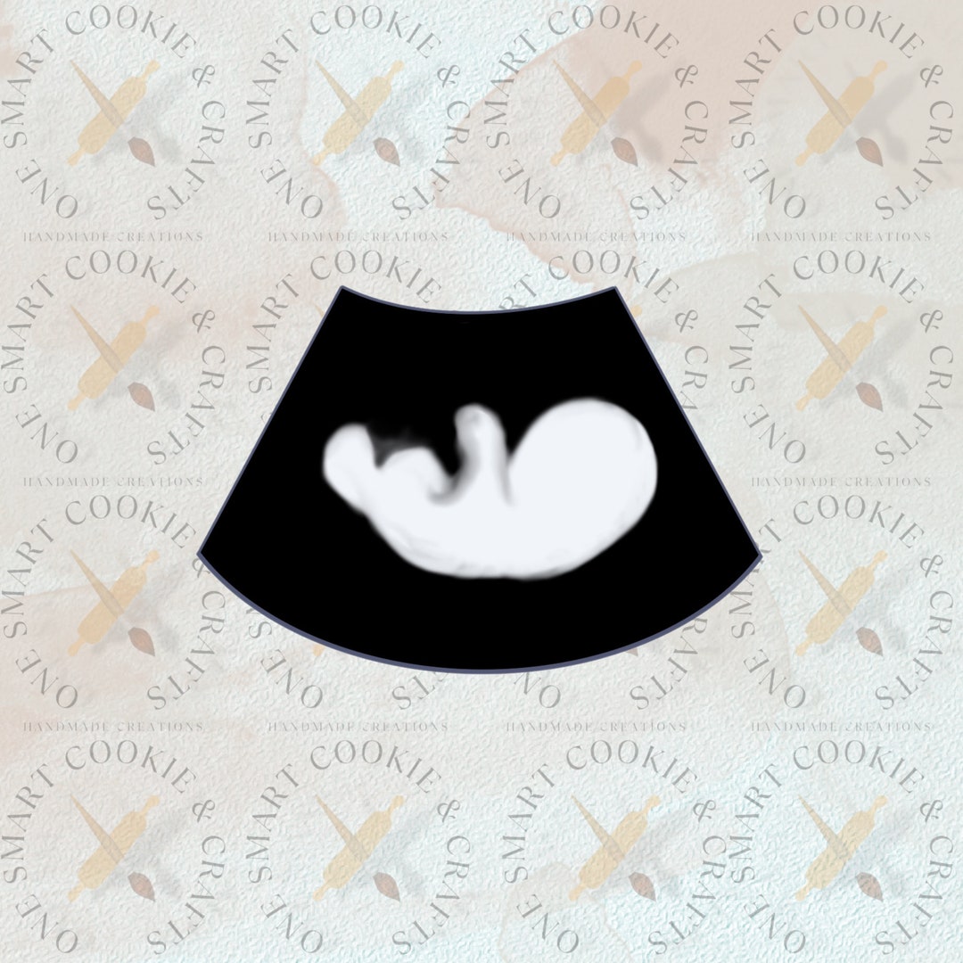 Ultrasound Cookie Cutter/baby Cookie Cutter/baby Shower Cookie Cutter ...