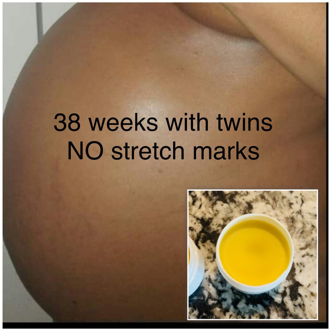 Tummy Butter Mark Butter Hydration Cream Dry Skin - Etsy