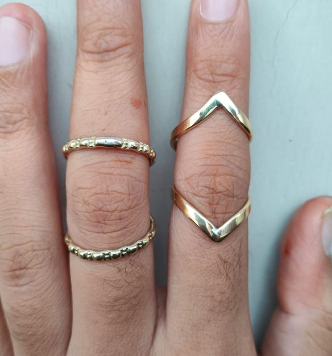 Trigger Finger Rings, Arthritis Rings, EDS Finger Splint Rings, Mallet ...