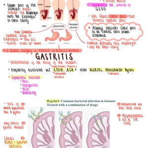 Notes on GI Tract Diseases - Etsy