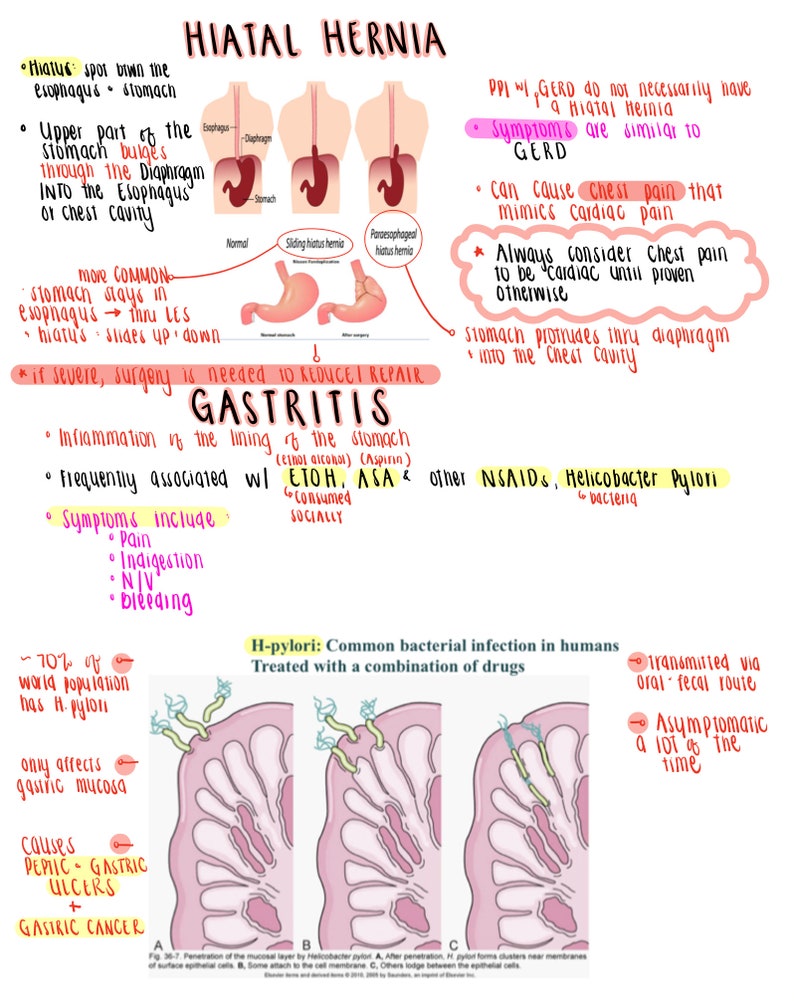 Notes on GI Tract Diseases - Etsy