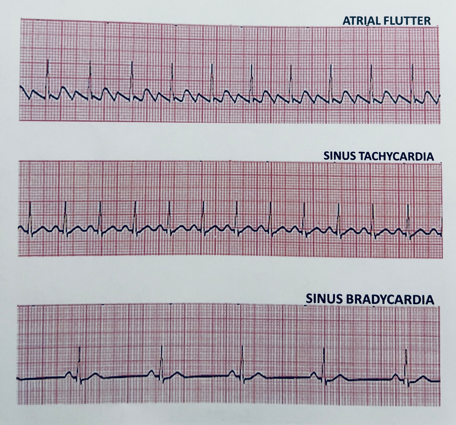 New 2025 EKG Exam | Instant Download | EKG Study Guide | EKG | Nursing ...